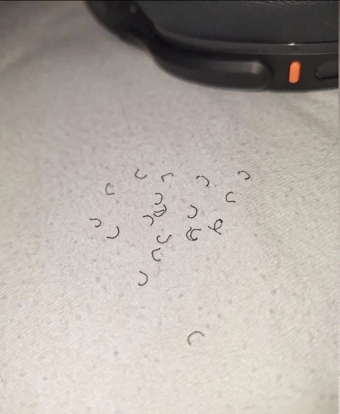 Woke Up To This On Your Bed? The Truth Will Shock You! – Best Recipes